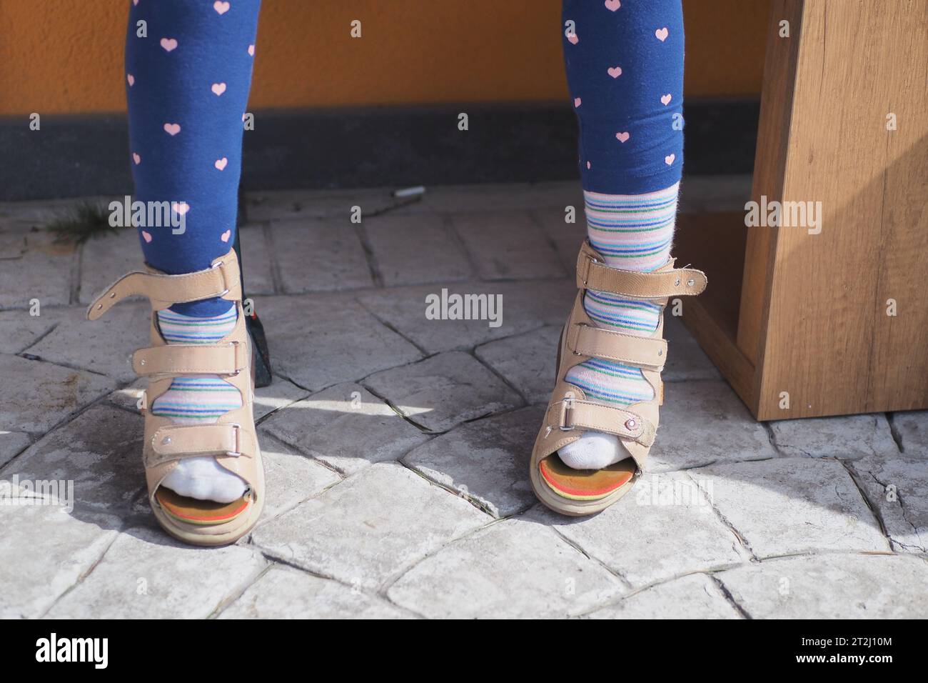 Child cerebral palsy disability legs orthosis shoes sitting on bench ...