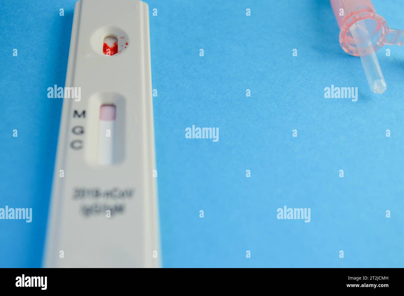 Blood Sample With Fat at Herbert Yamasaki blog