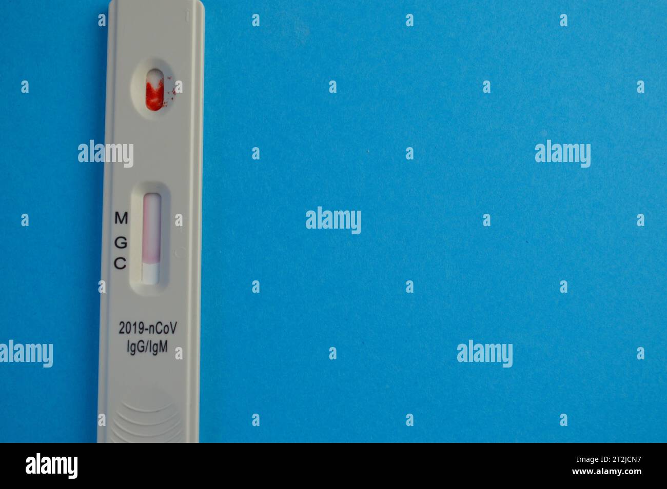 Medical laboratory technician placing blood sample specimen on quick ...
