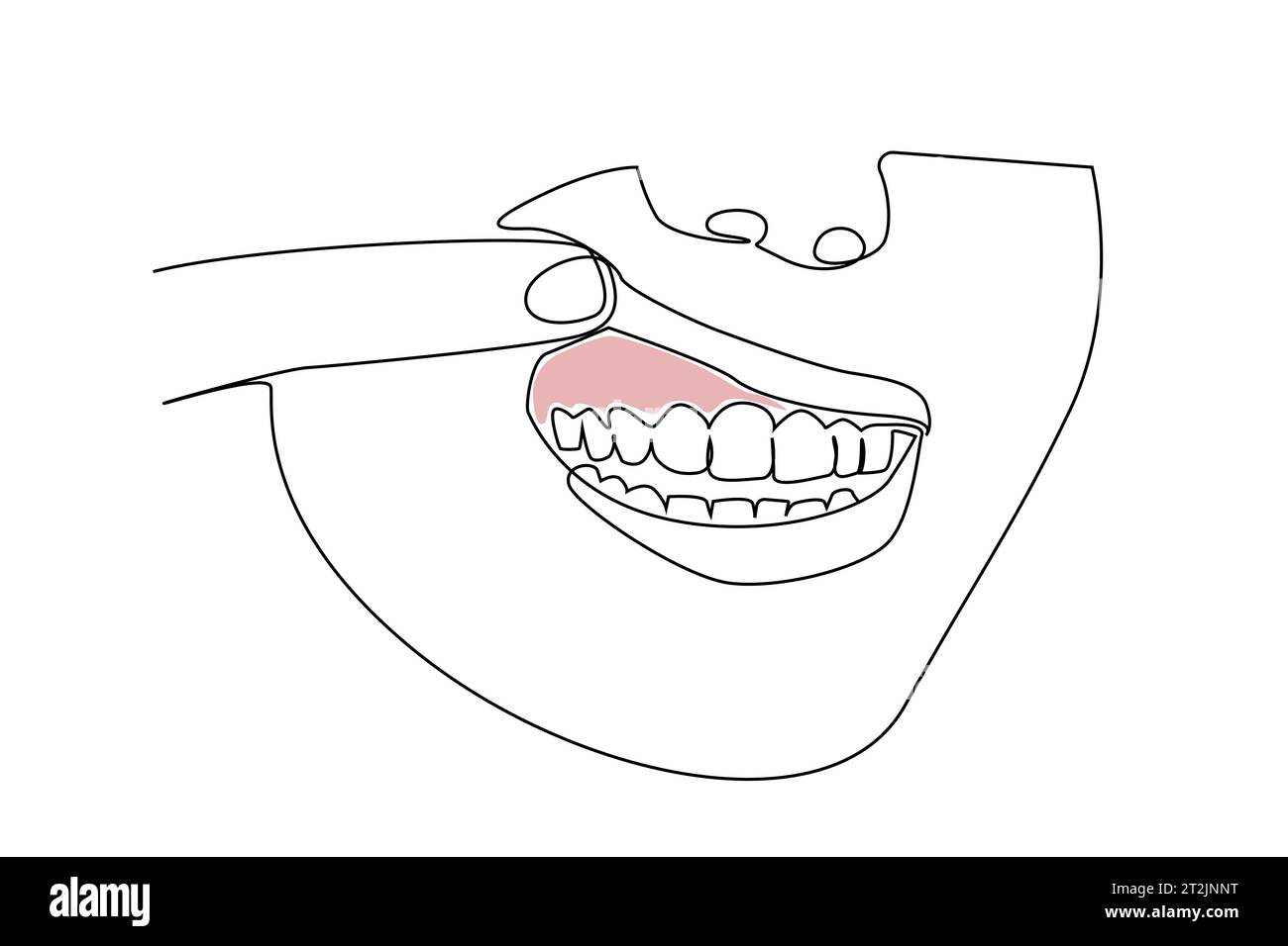 woman mouth oral dental disease gum reddened disease line art Stock ...