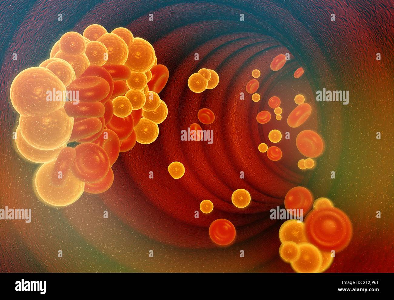 Cholesterol in blood vessels. 3d illustration Stock Photo - Alamy