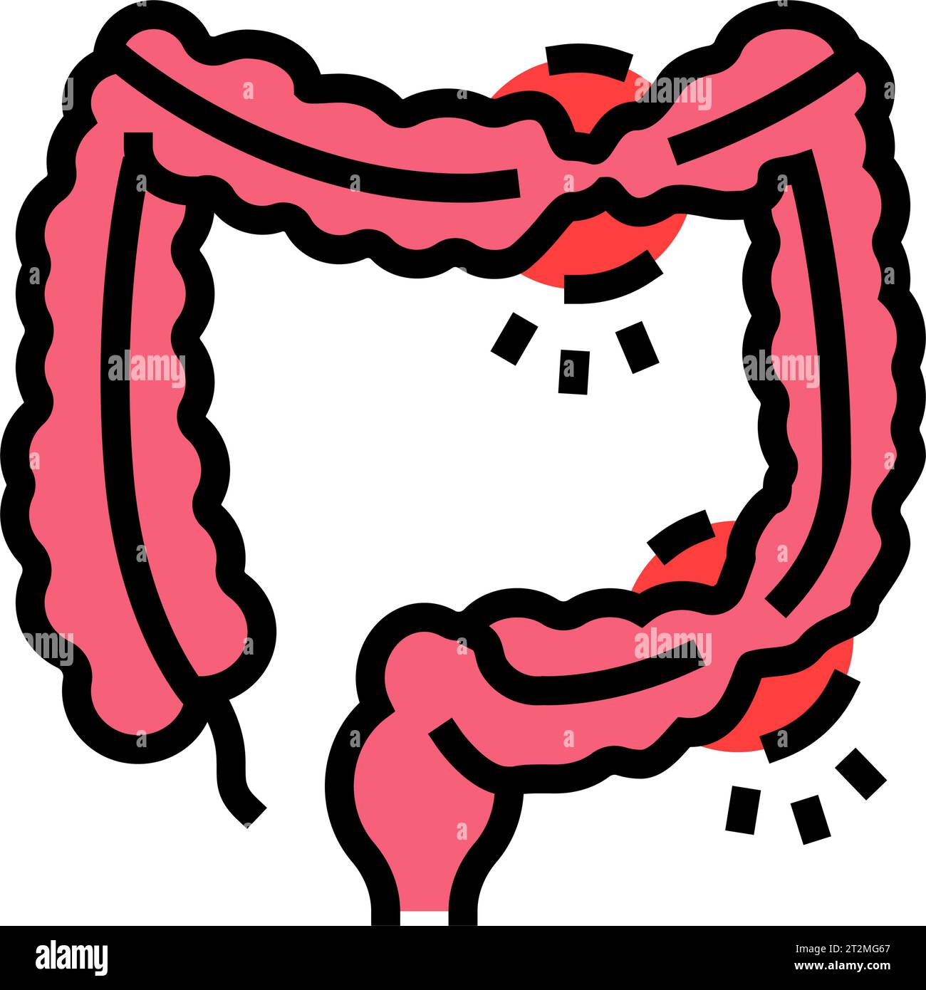 irritable bowel syndrome color icon vector illustration Stock Vector ...