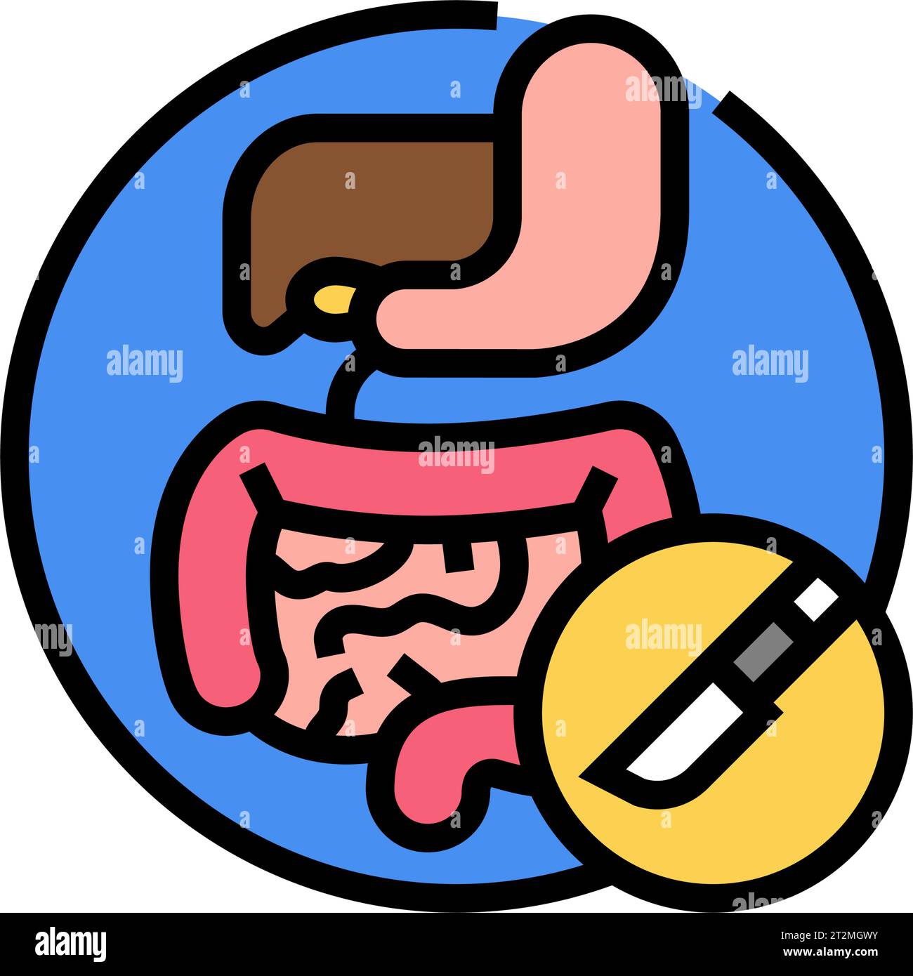 gastrointestinal surgery color icon vector illustration Stock Vector ...