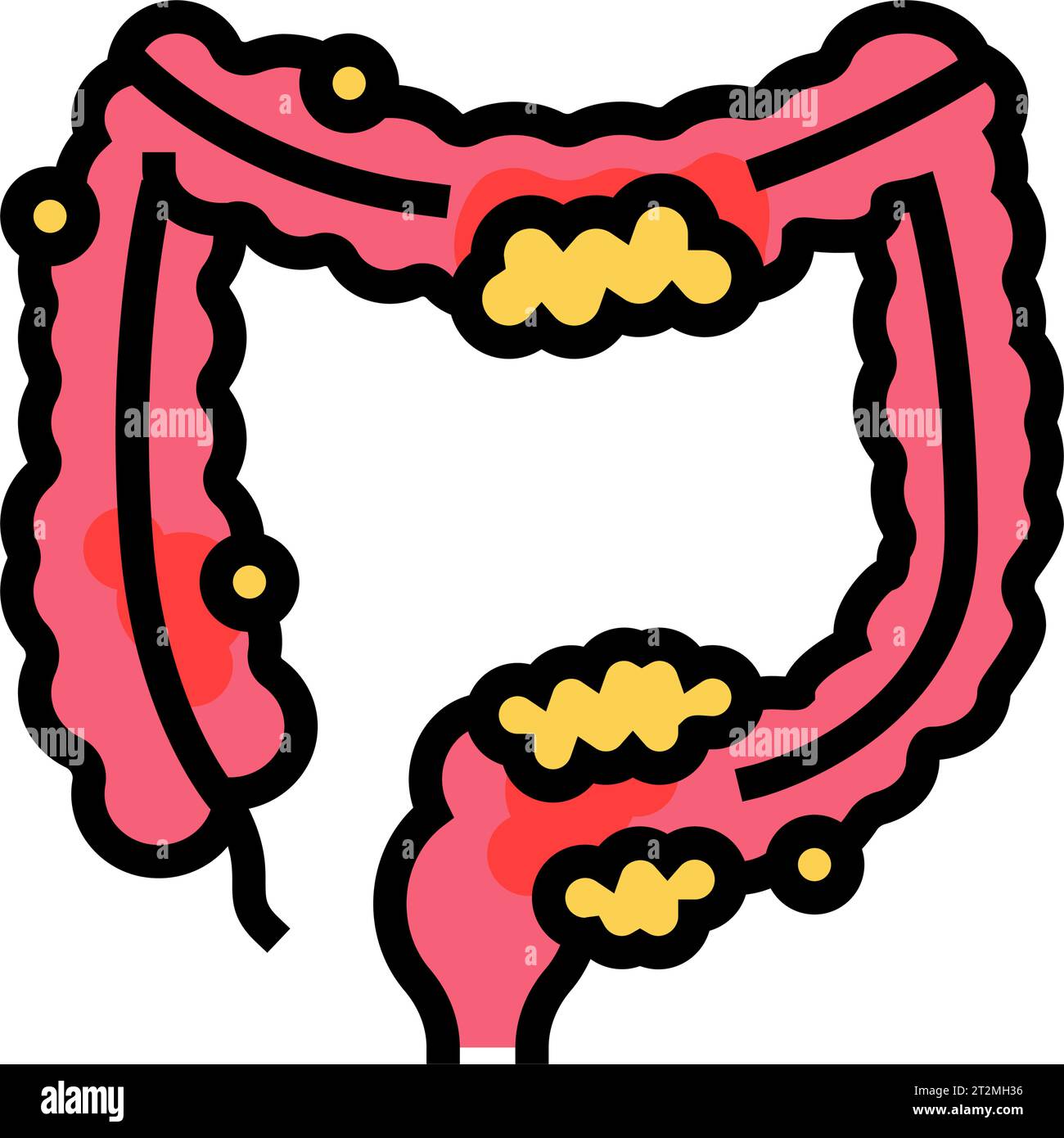 crohn disease gastroenterologist color icon vector illustration Stock ...