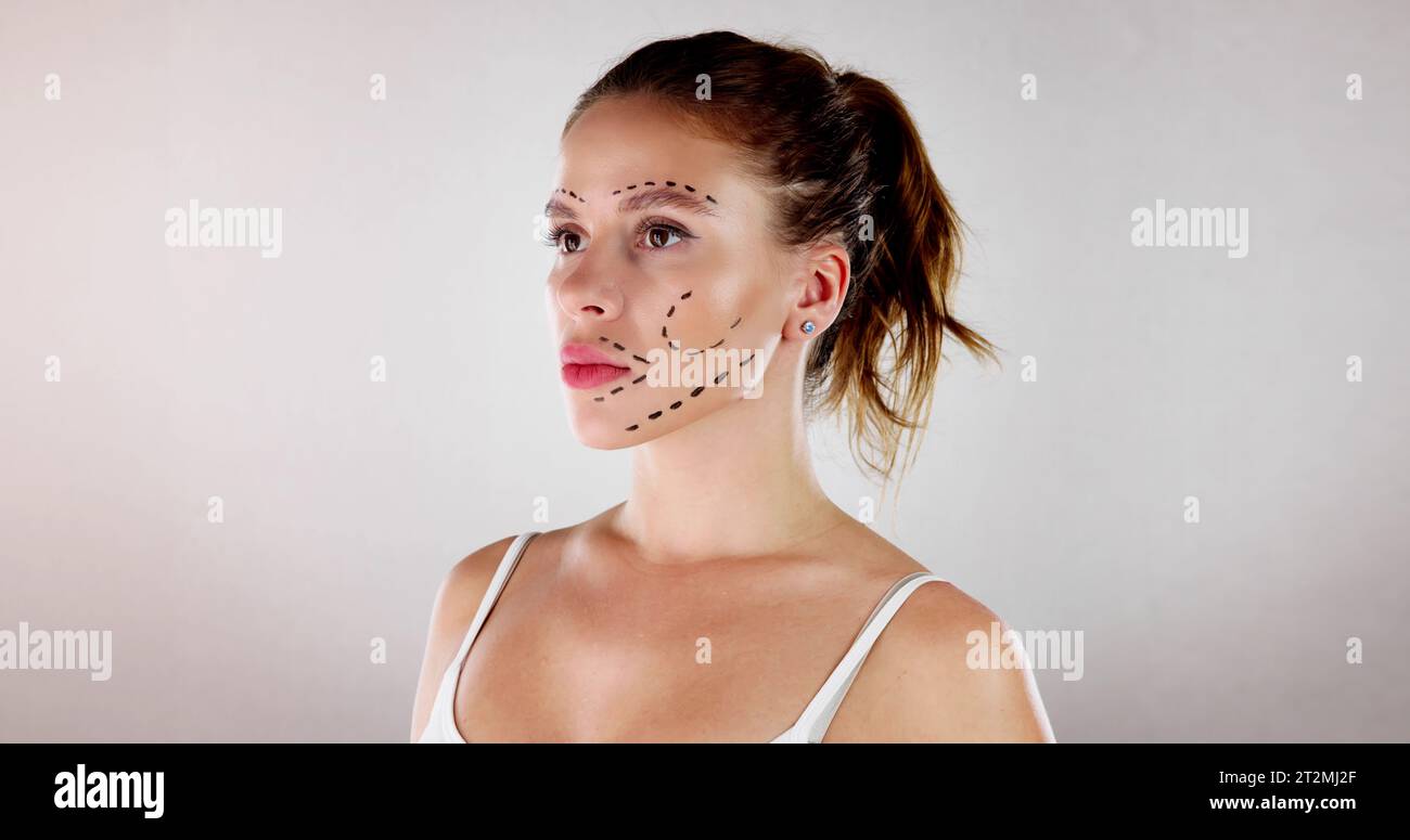 Facial Aesthetics Facelift. Plastic Surgery Drawings On Face Stock ...