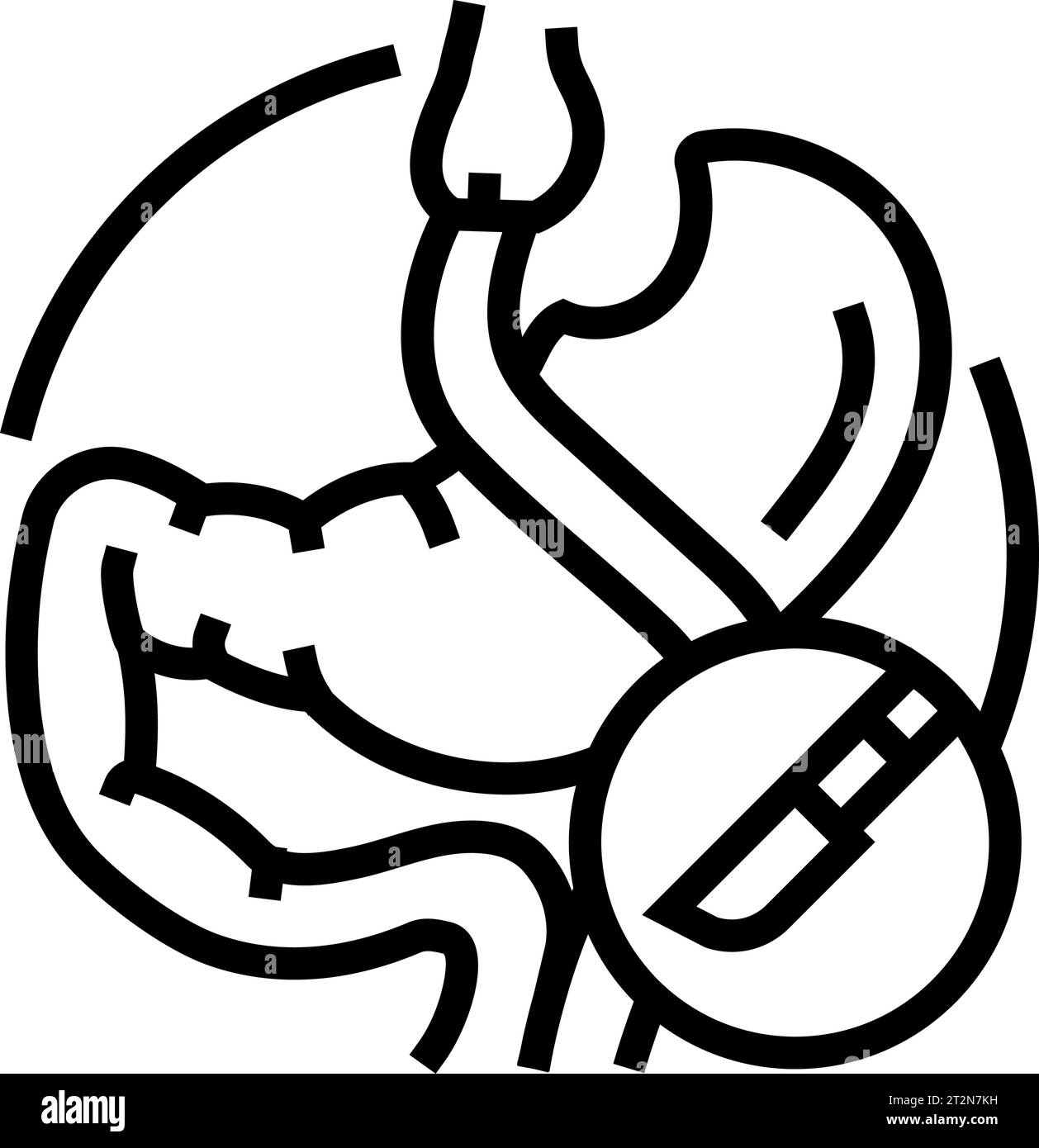 Gastric Bypass Gastroenterologist Line Icon Vector Illustration Stock Vector Image And Art Alamy