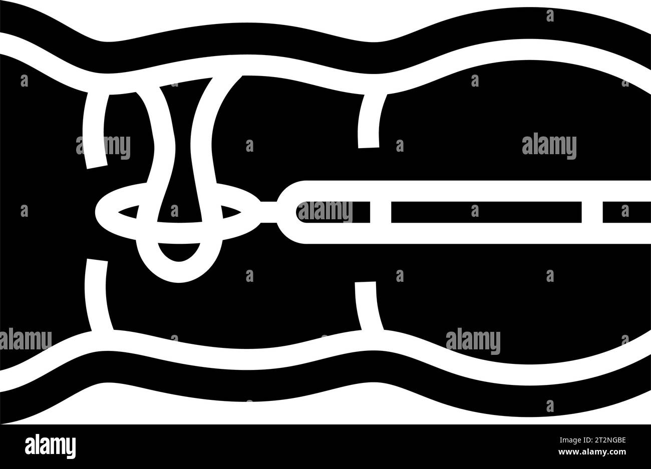 colon polyps gastroenterologist glyph icon vector illustration Stock ...