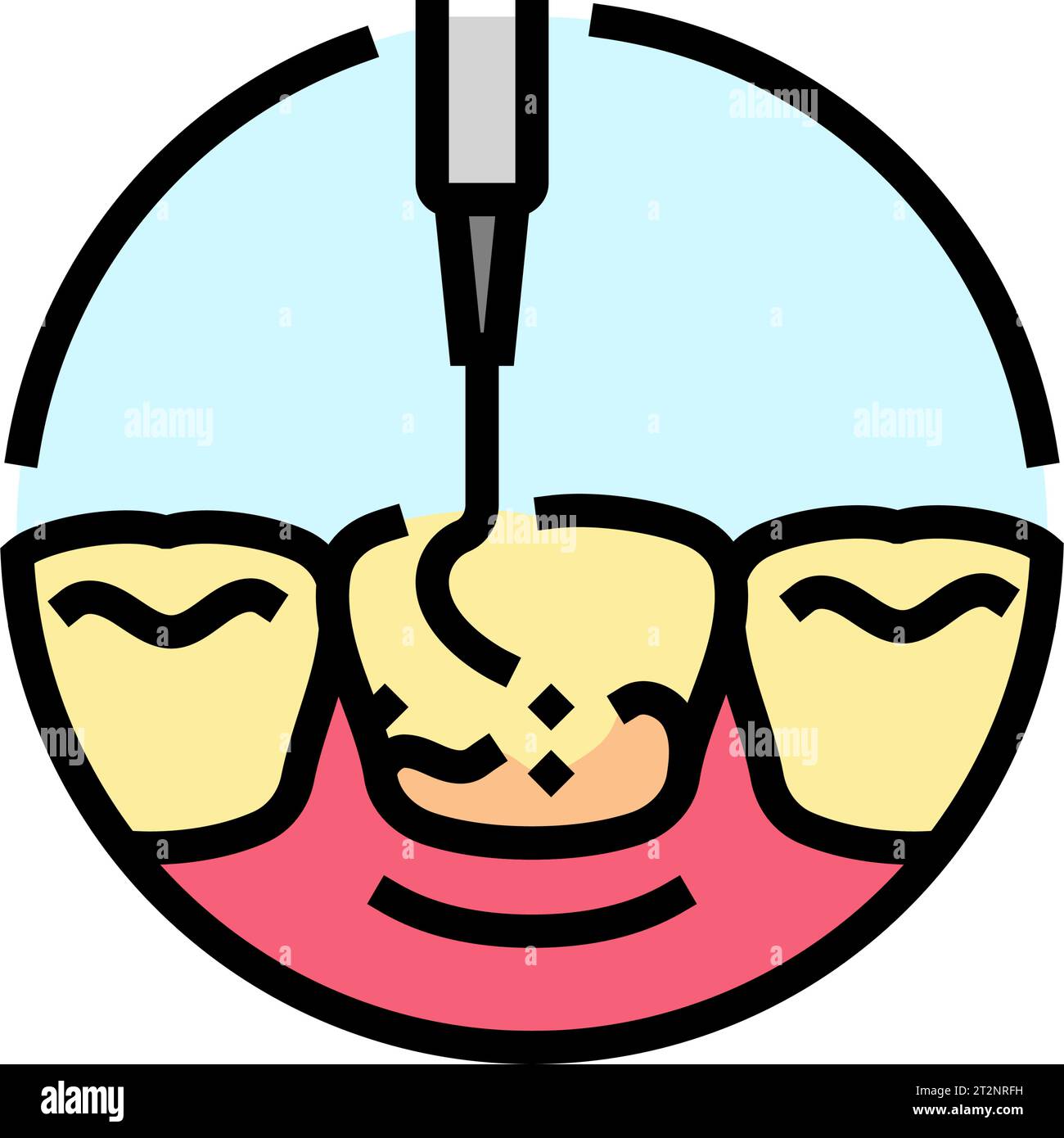 scaling dental procedure color icon vector illustration Stock Vector ... scaling dental procedure color icon vector illustration Stock Vector ...