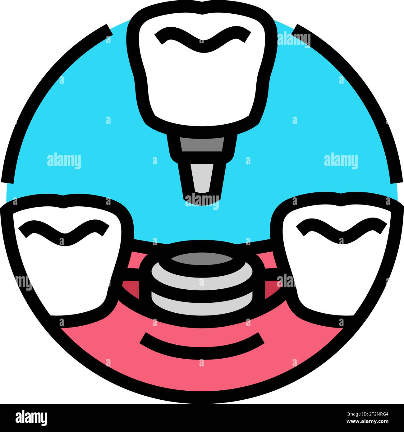 implant dental procedure color icon vector illustration Stock Vector ...