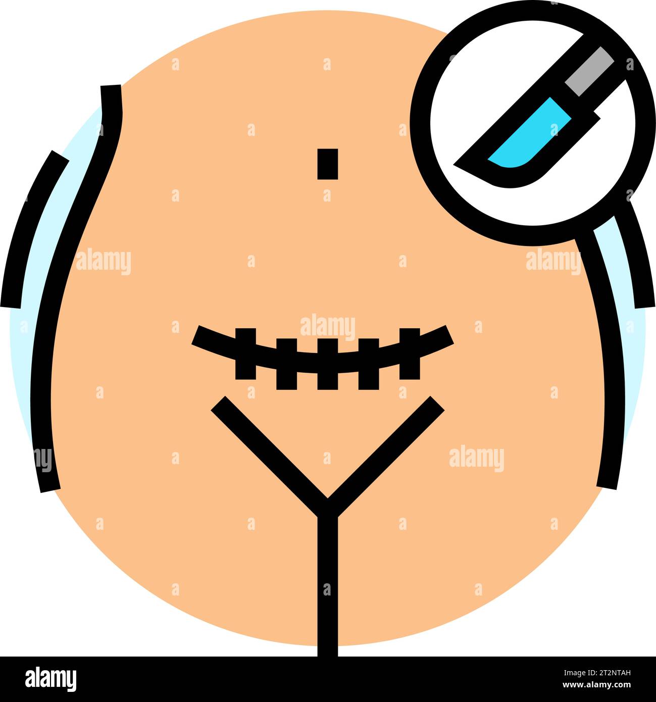 Cesarean Section Gynecologist Color Icon Vector Illustration Stock Vector Image And Art Alamy