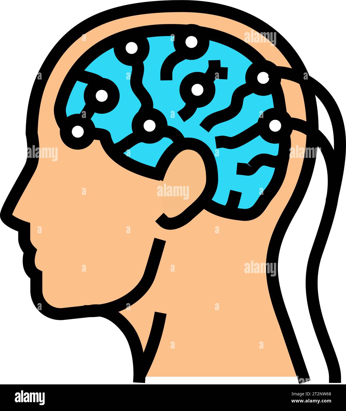 Brain mri seizure Stock Vector Images - Alamy