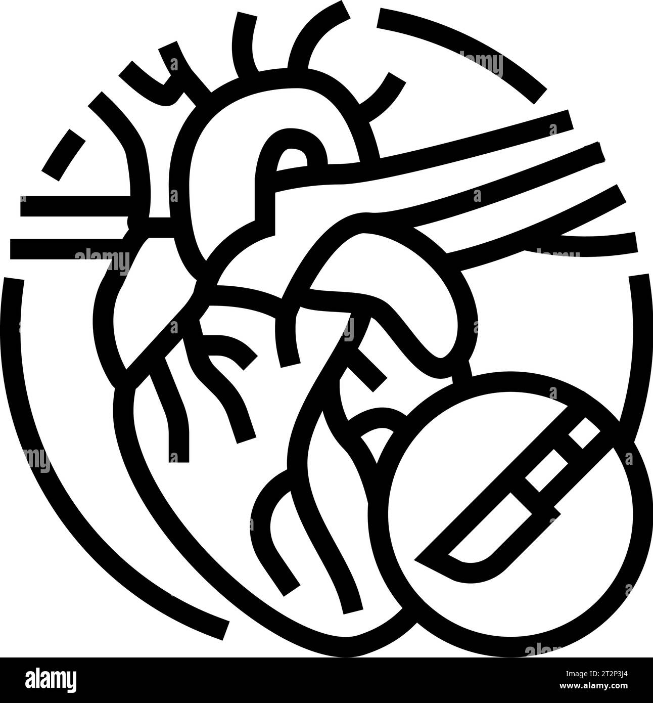 Heart surgery surgeon Black and White Stock Photos & Images - Alamy