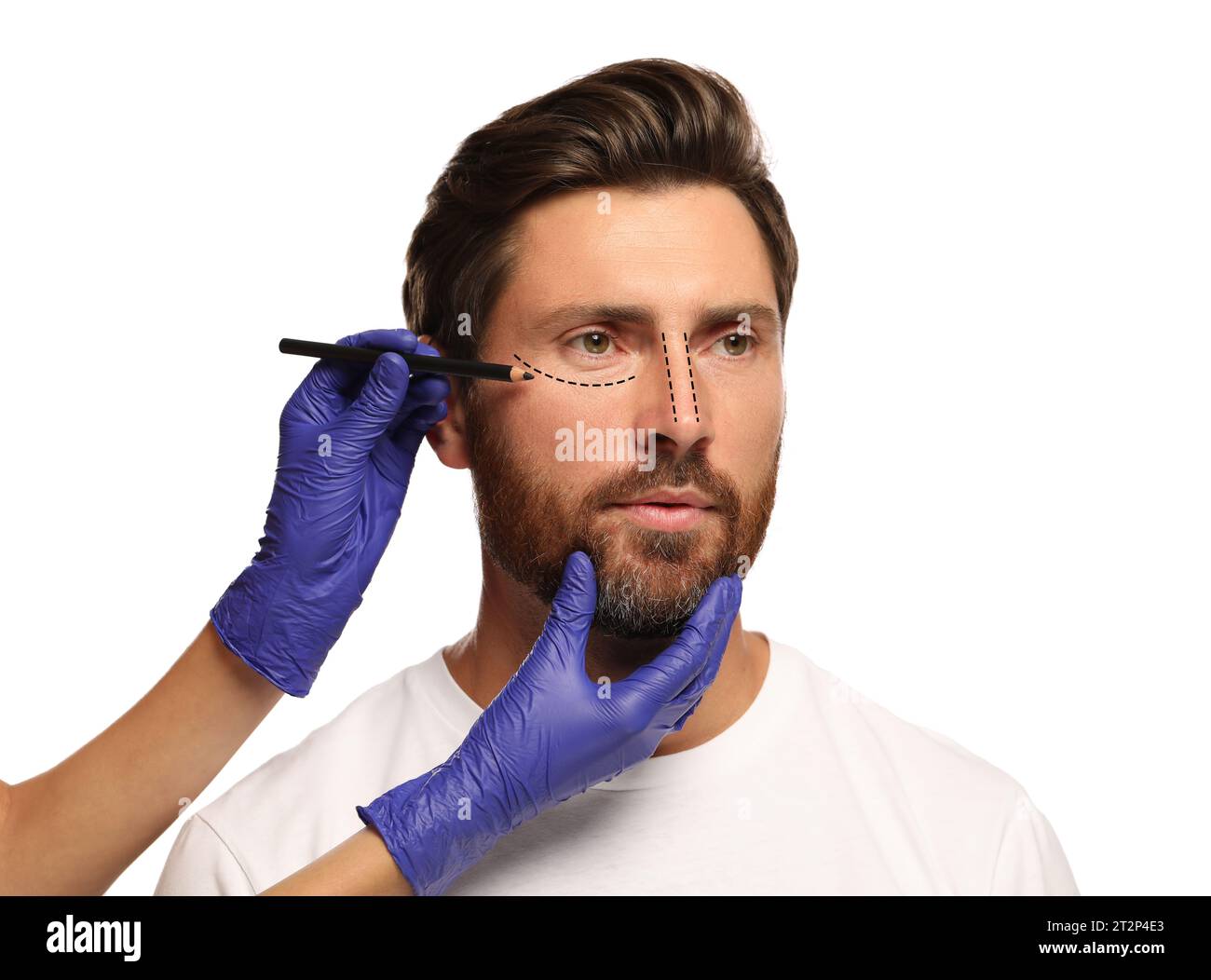 Man preparing for cosmetic surgery, white background. Doctor drawing ...