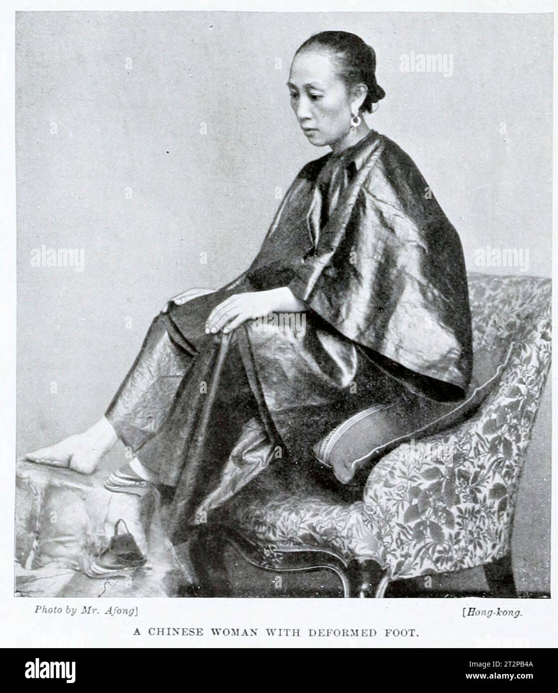 Chinese woman with bound foot Stock Photo - Alamy