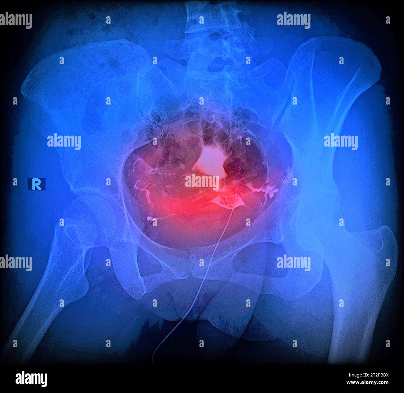 Female human body abdomen hi-res stock photography and images - Alamy