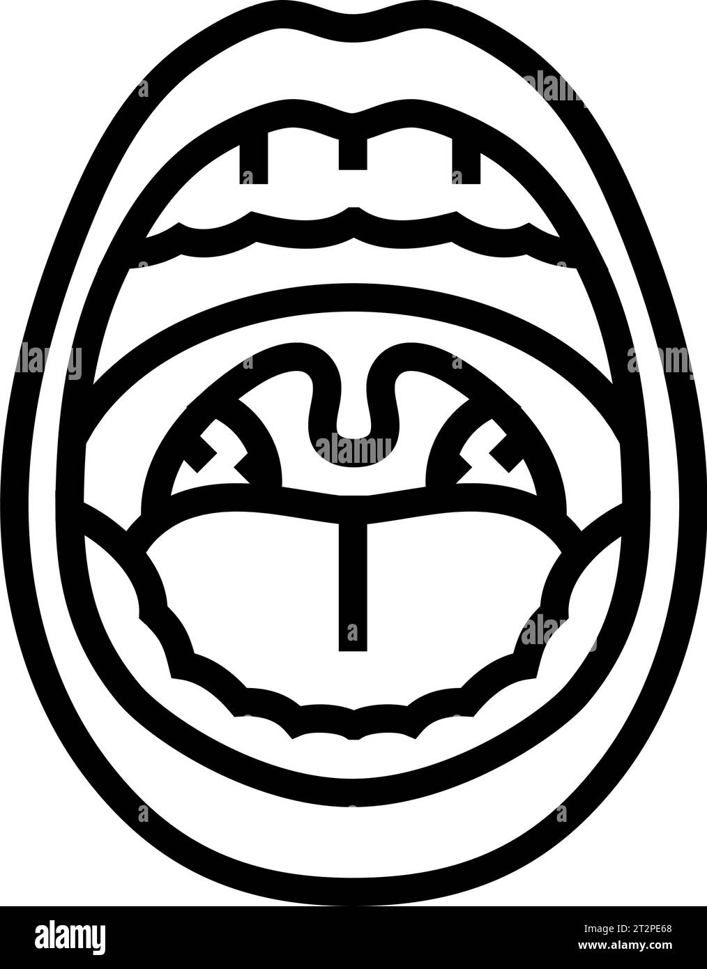 swollen tonsils disease symptom line icon vector illustration Stock ...