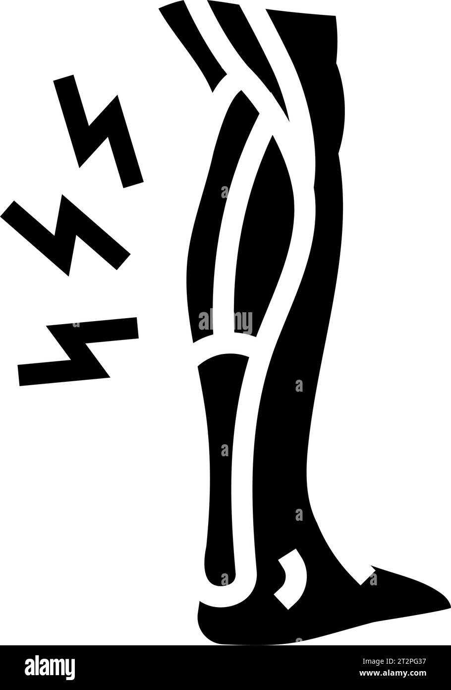 Muscle spasms Black and White Stock Photos & Images - Alamy