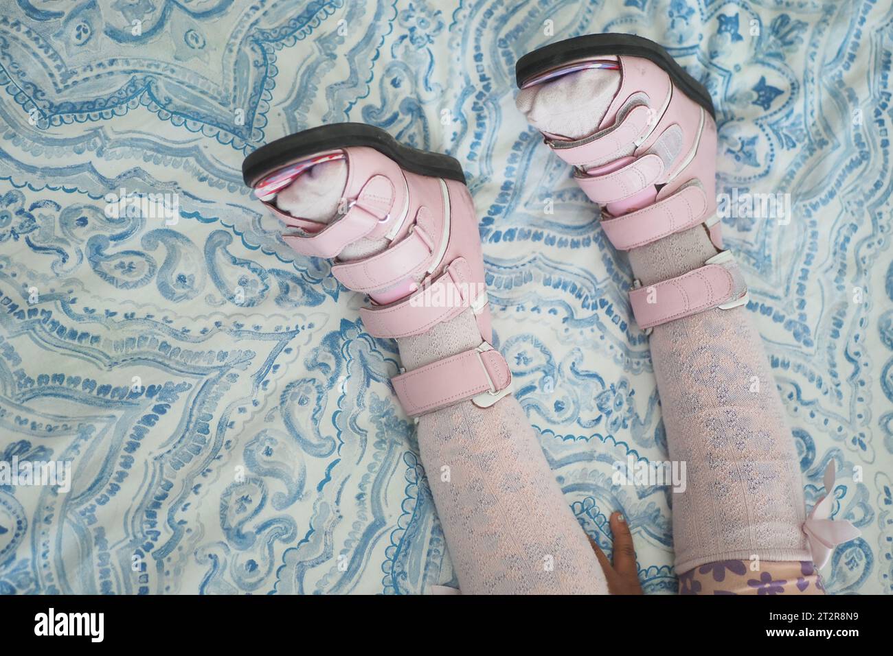 Child cerebral palsy disability, legs orthosis Stock Photo - Alamy