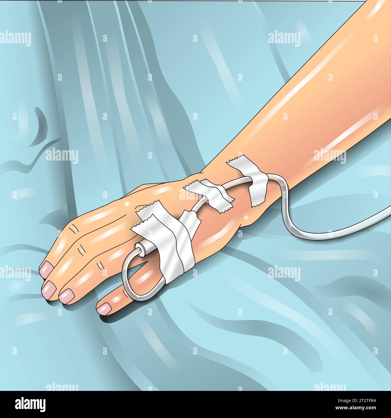 Patient's hand with drip receiving a saline solution Stock Photo - Alamy