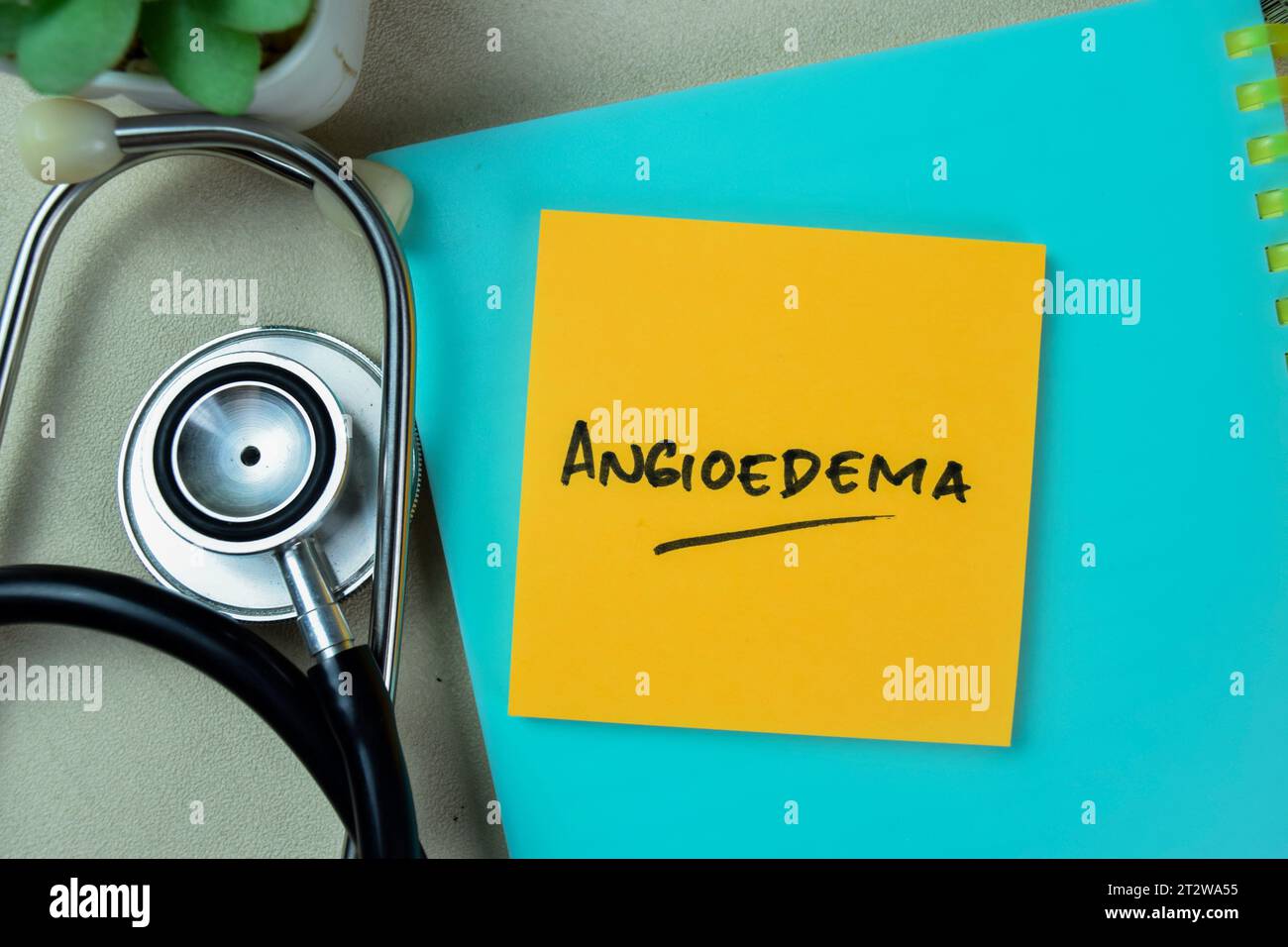 Concept Of Angioedema Write On Sticky Notes With Stethoscope Isolated