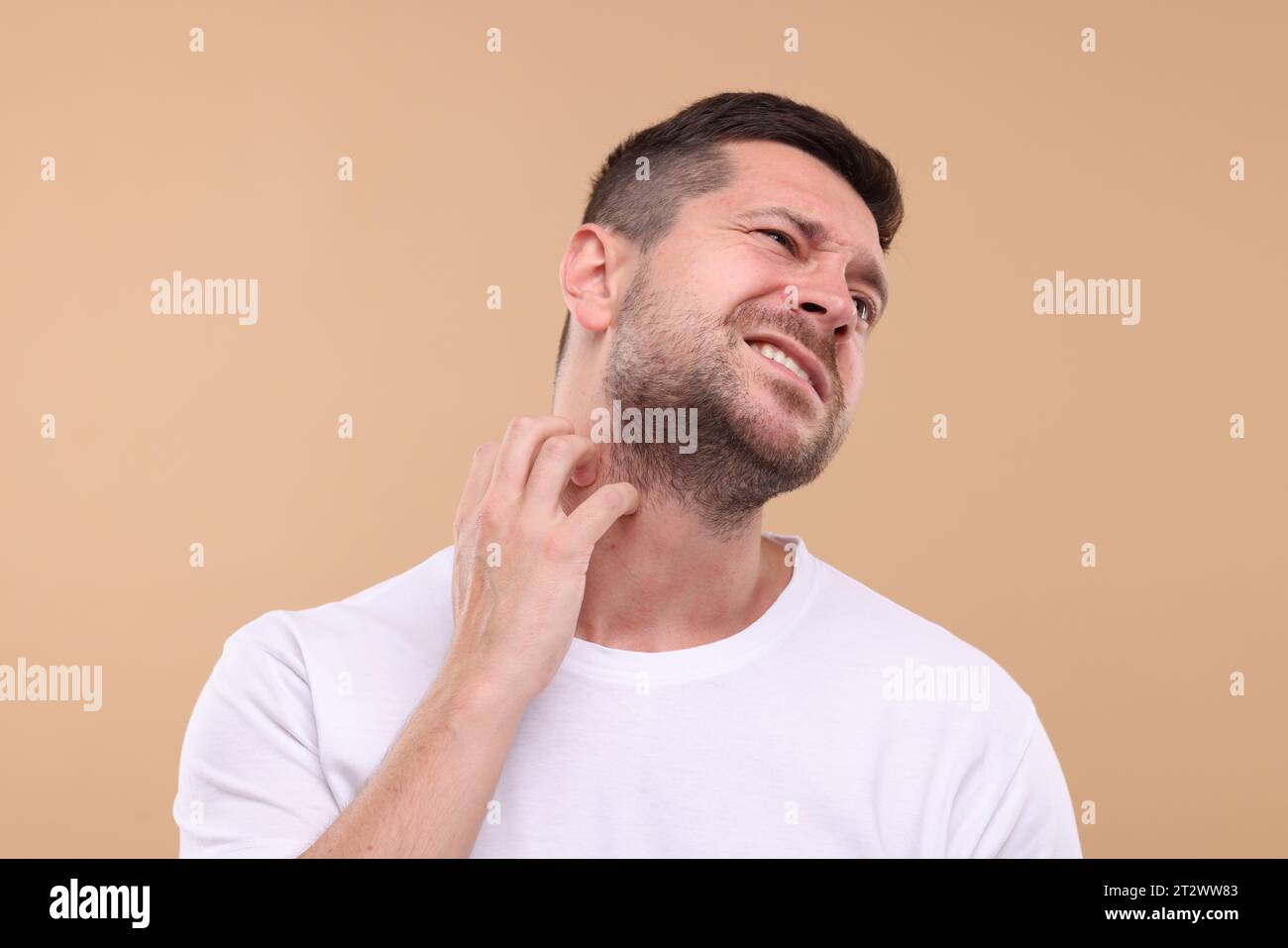 Man scratching neck rash hi-res stock photography and images - Alamy