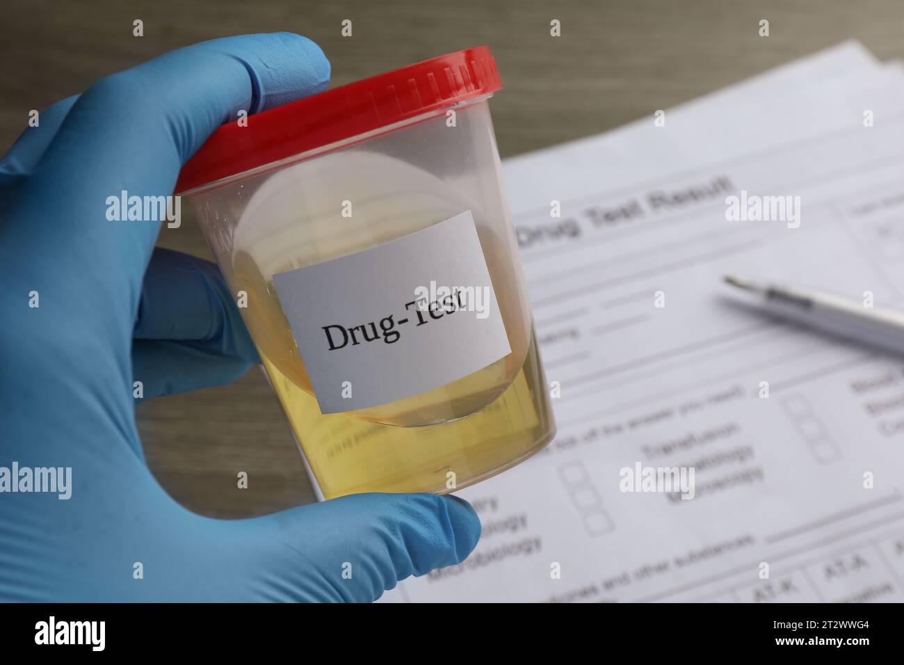 Drug test. Laboratory worker holding container with urine sample at ...