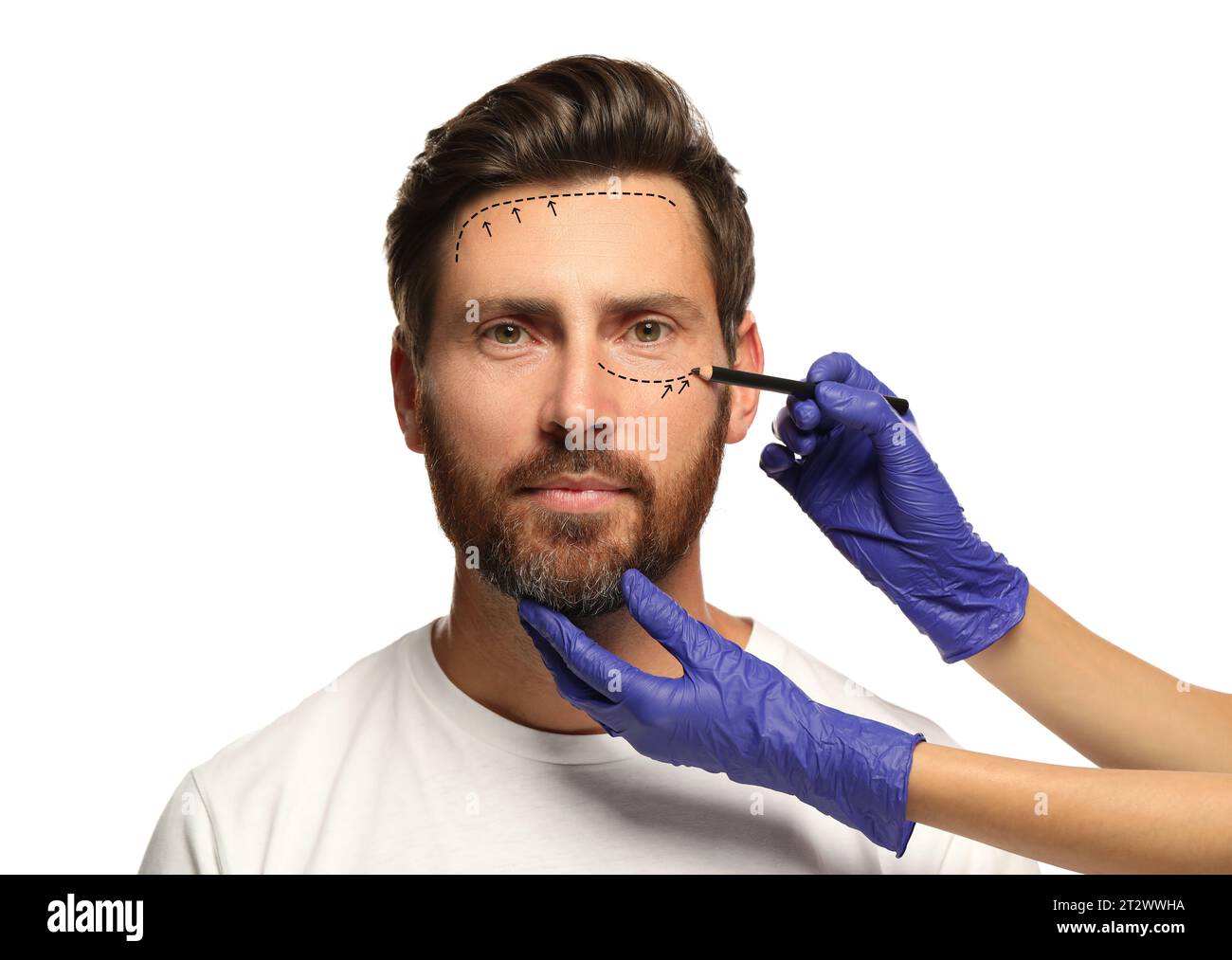 Man preparing for cosmetic surgery, white background. Doctor drawing ...
