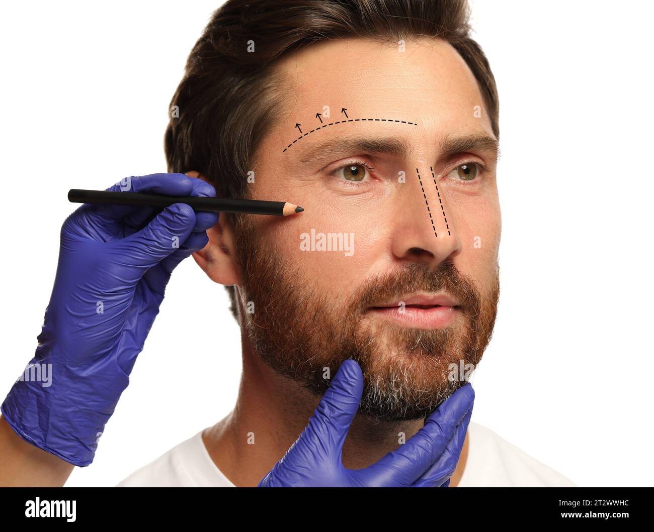 Man preparing for cosmetic surgery, white background. Doctor drawing ...