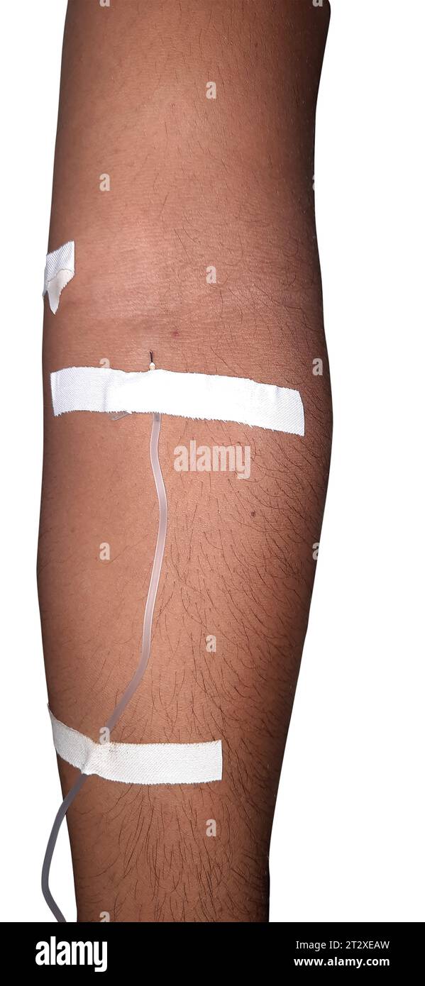 Male patient receiving infusion therapy in hospital, inserting venous ...