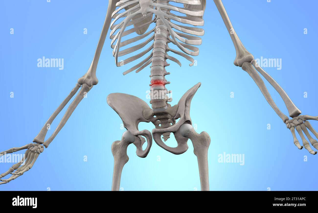 Anatomy of Human Spine. Lower back pain and human backache Stock Photo ...