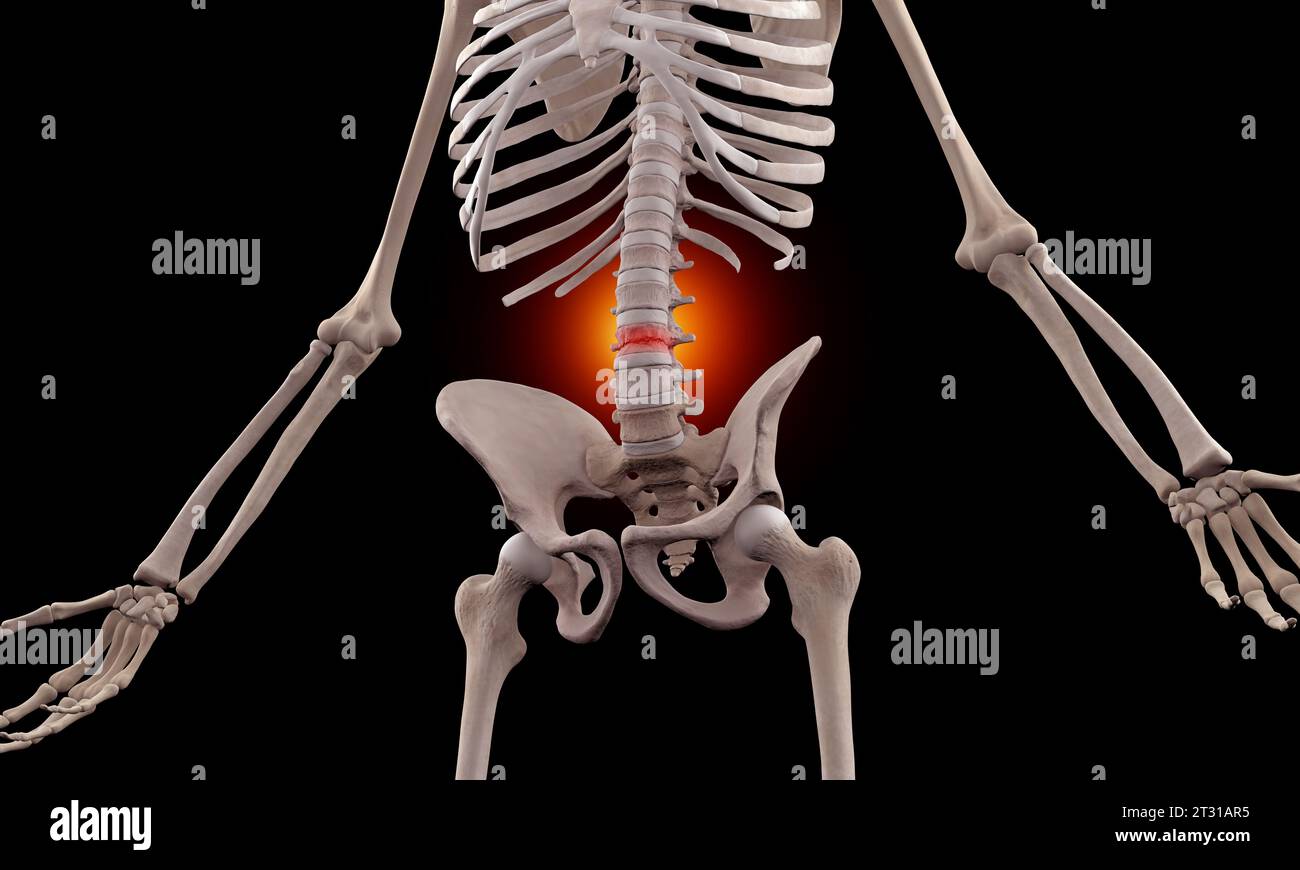 Anatomy of Human Spine. Lower back pain and human backache Stock Photo ...
