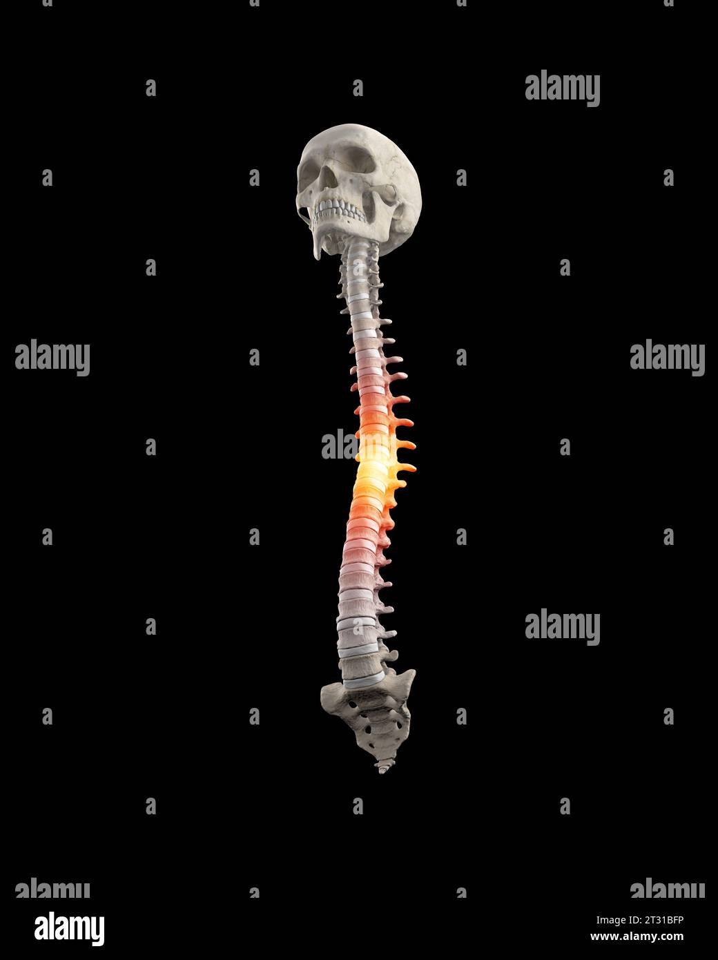 Human spine with pain in thoracic region Stock Photo - Alamy