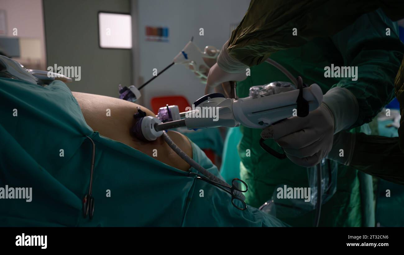 Obesity surgery. Weight loss surgery is performed with laparoscopic ...