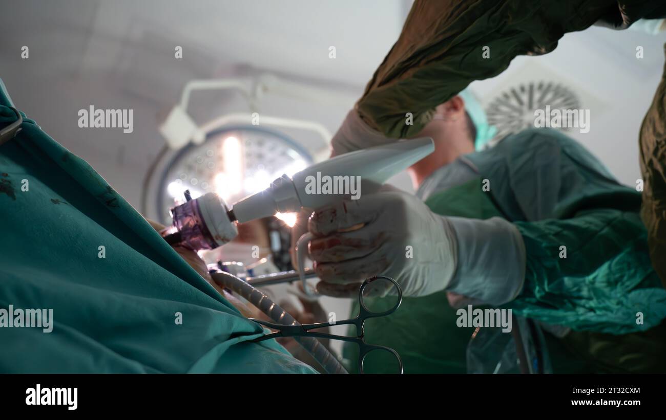 Obesity surgery. Weight loss surgery is performed with laparoscopic ...