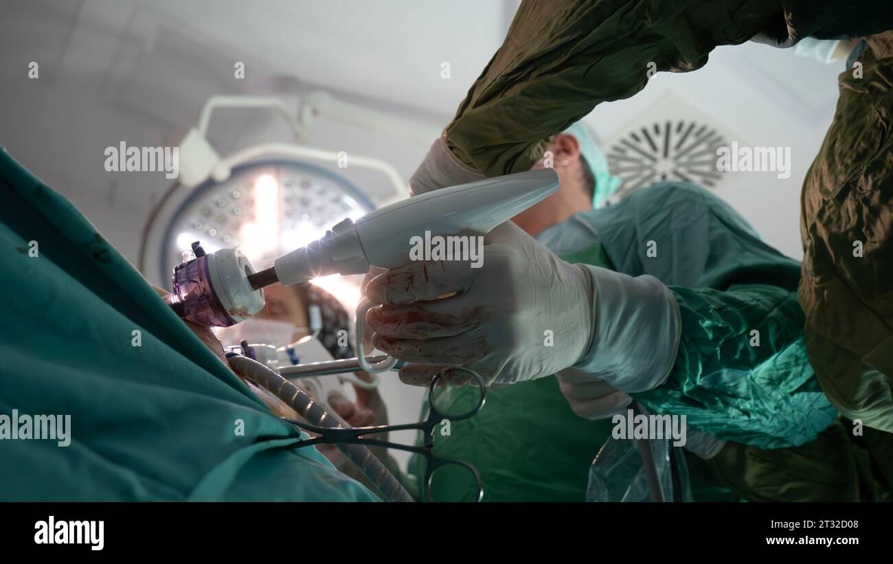 Obesity surgery. Weight loss surgery is performed with laparoscopic ...