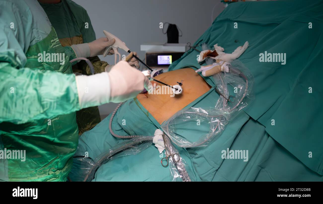 Obesity surgery. Weight loss surgery is performed with laparoscopic ...