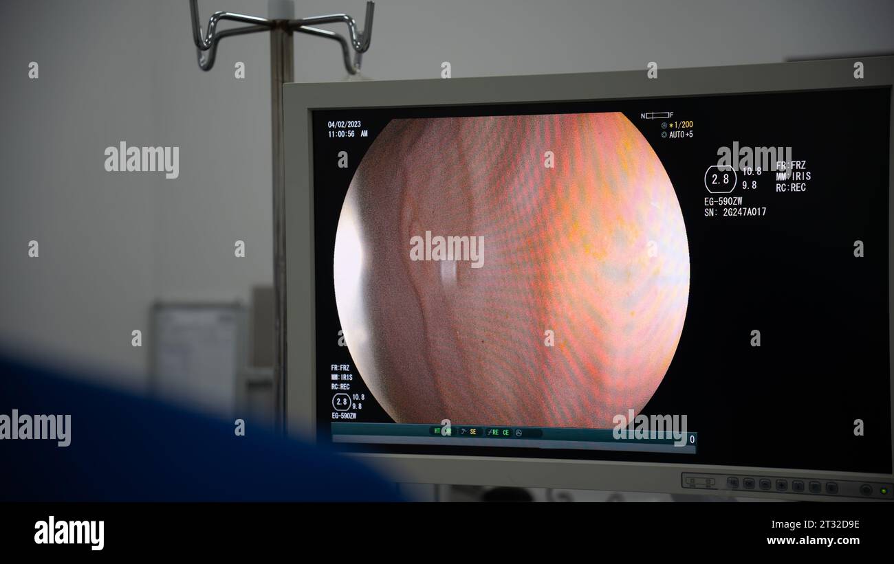 While performing laparoscopic surgery, the doctor watches the details ...