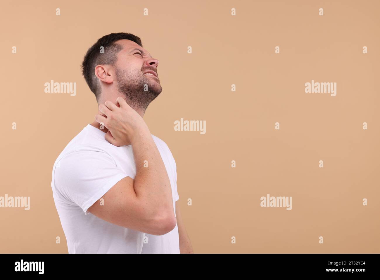 Man scratching neck rash hi-res stock photography and images - Alamy