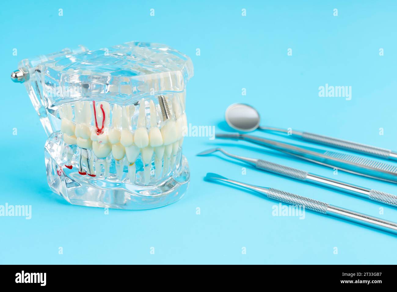 Human jaw or Acrylic dentures model with implants and dental tools on ...