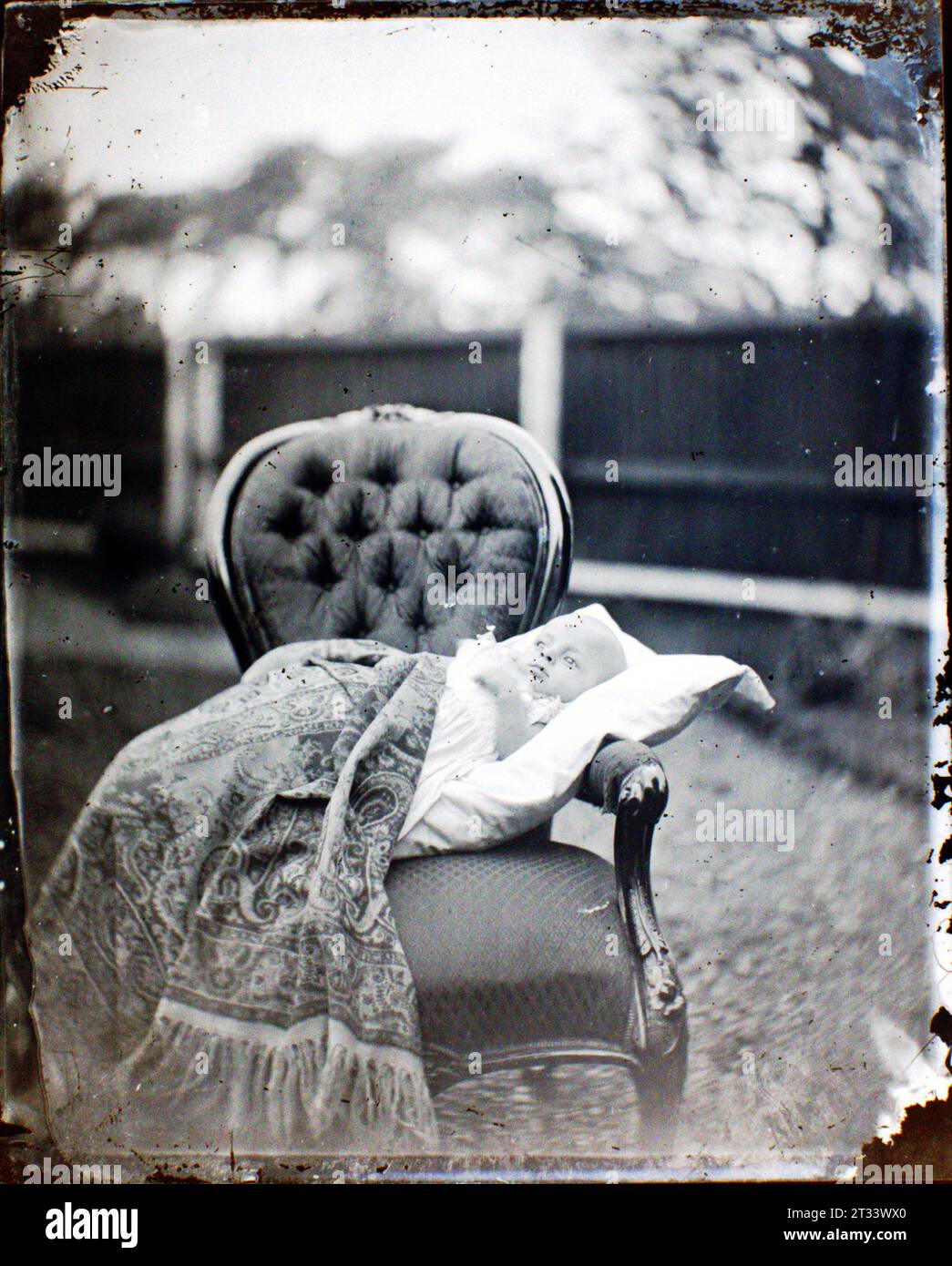 Collodion baby hi-res stock photography and images - Alamy