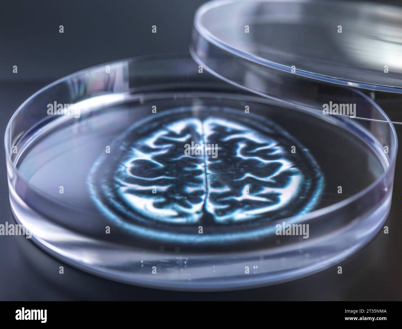 Testing for alzheimer's disease hi-res stock photography and images - Alamy