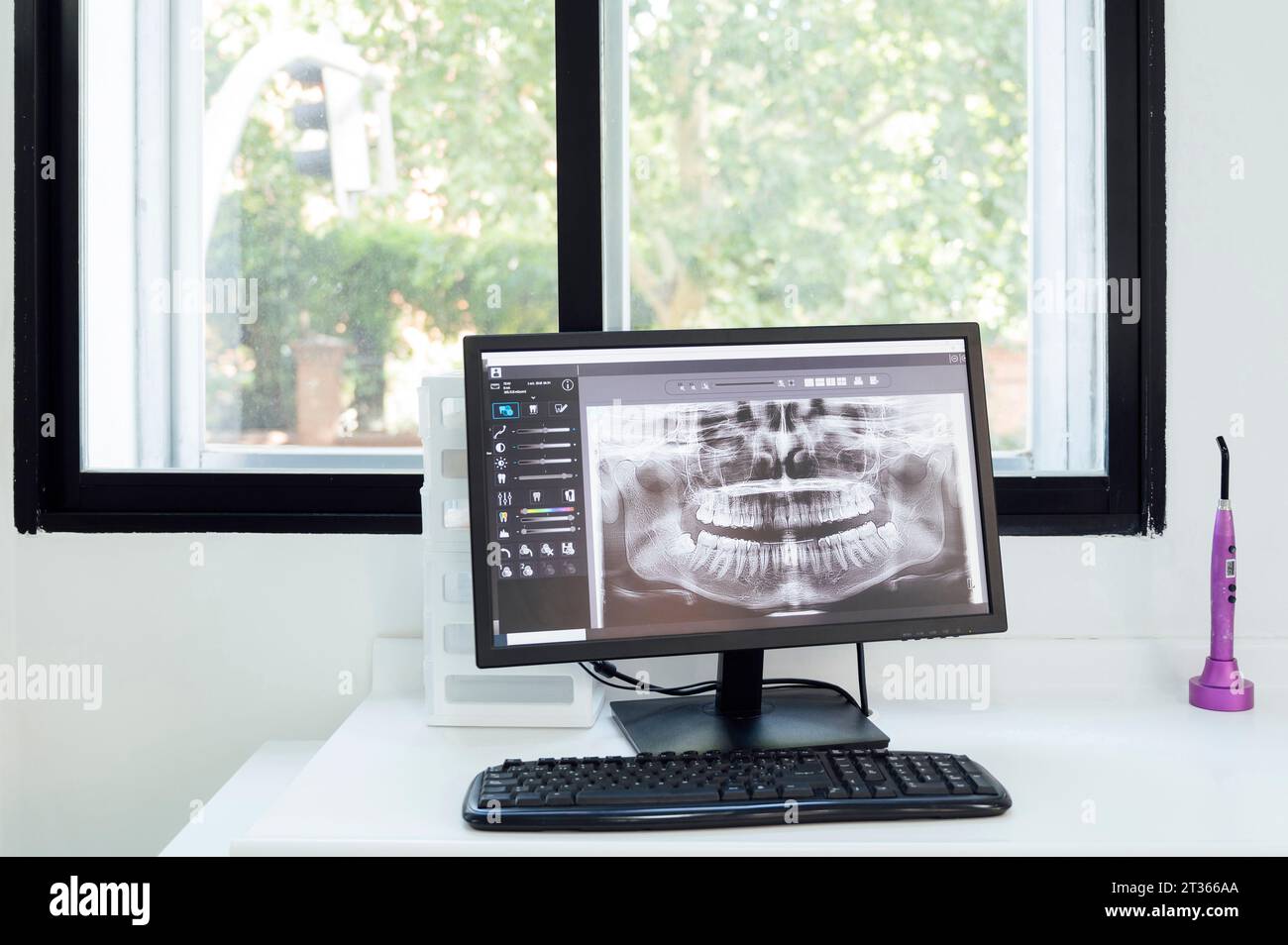 Teeth X-ray on computer at desk in clinic Stock Photo - Alamy