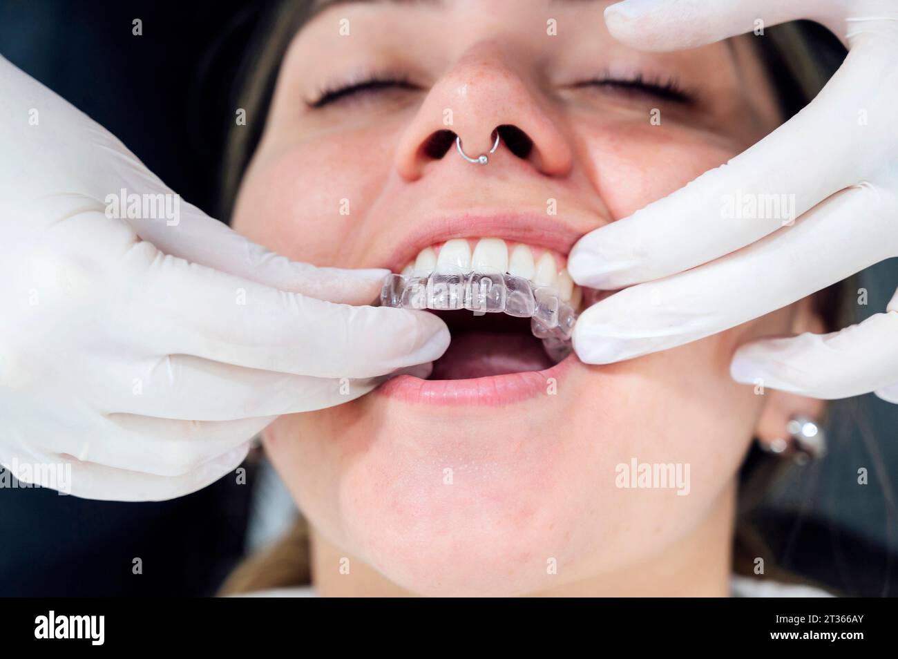 Hands of dentist inserting dental aligner to patient at clinic Stock ...