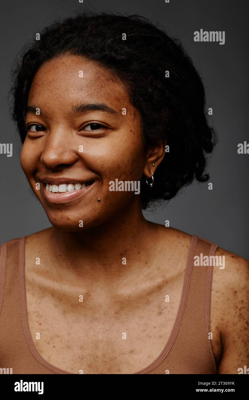 Smiling woman with acne scars against gray background Stock Photo - Alamy