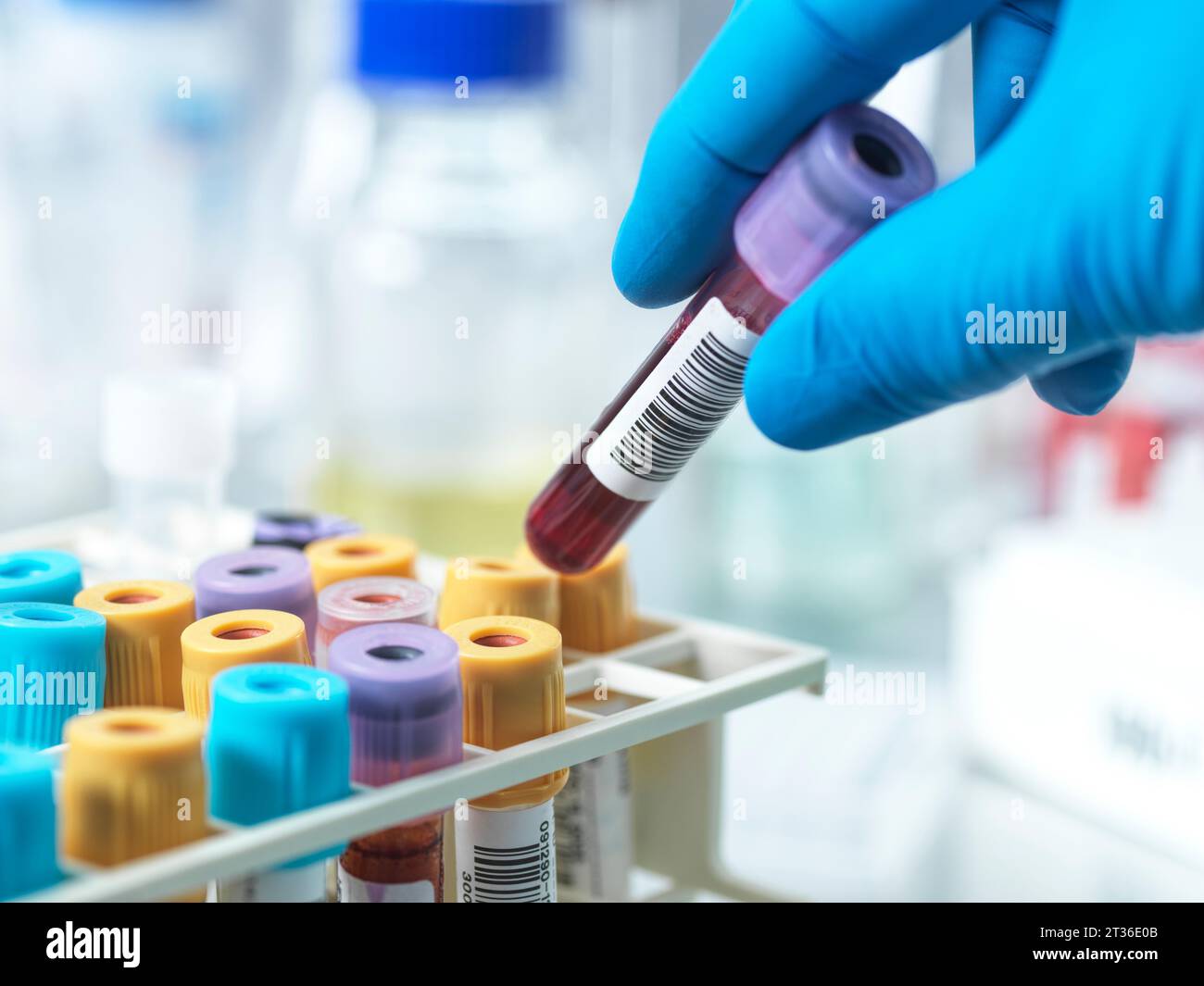 Hand of pathologist holding sample in test tube at laboratory Stock ...