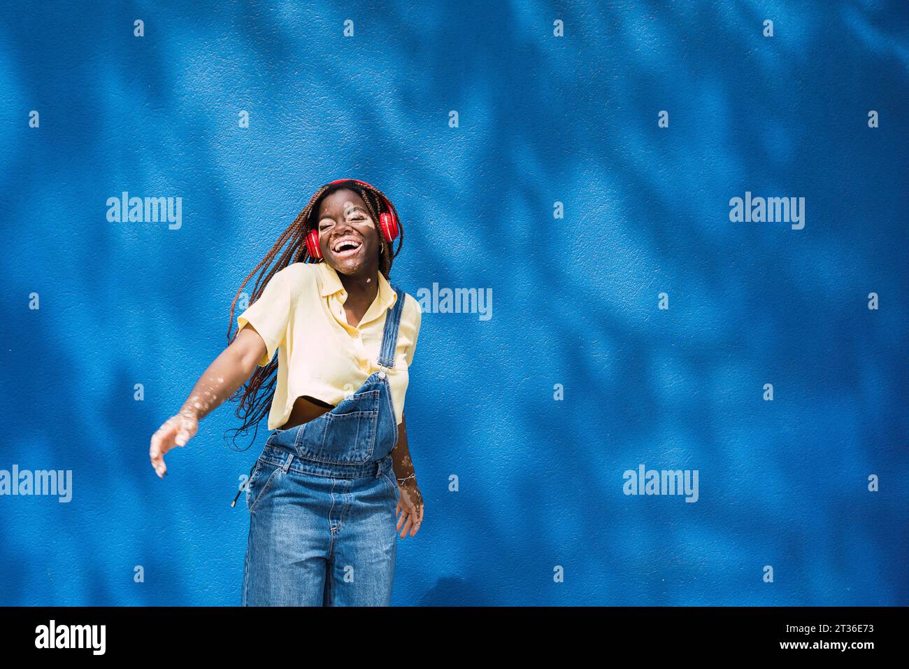 Young woman vitiligo smiling dancing hi-res stock photography and ...