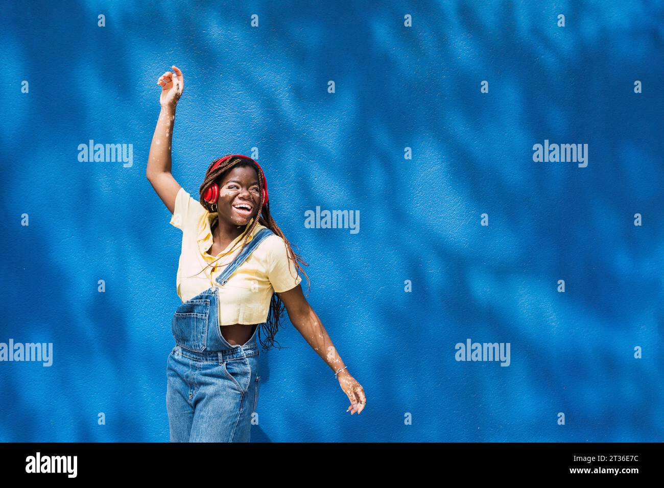 Young woman vitiligo smiling dancing hi-res stock photography and ...