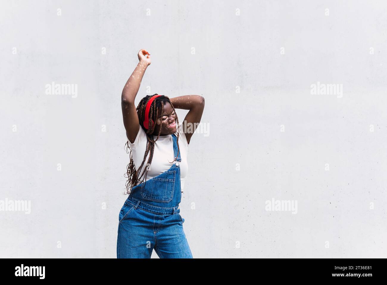 Young woman vitiligo smiling dancing hi-res stock photography and ...