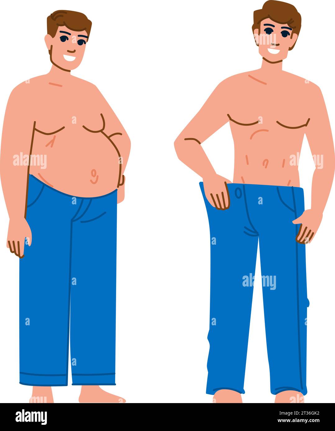 Weight loss surgery illustration Stock Vector Images - Alamy