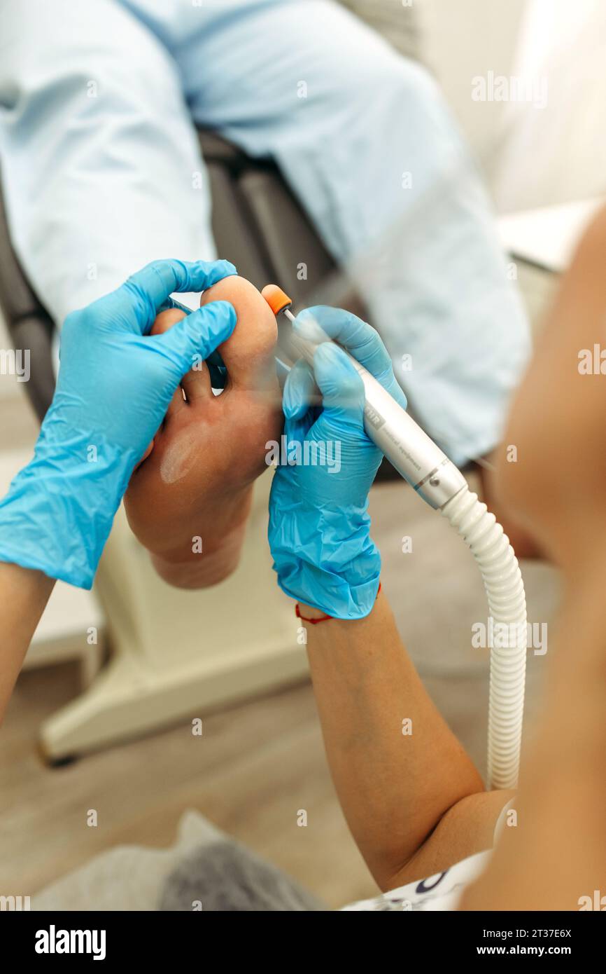 orthopedic doctor in blue gloves doing treatment of legs, close-up ...